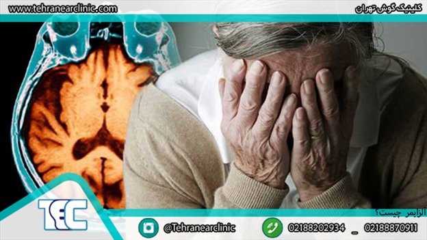 چگونگی تاثیر کم شنوایی در ابتلا به آلزایمر